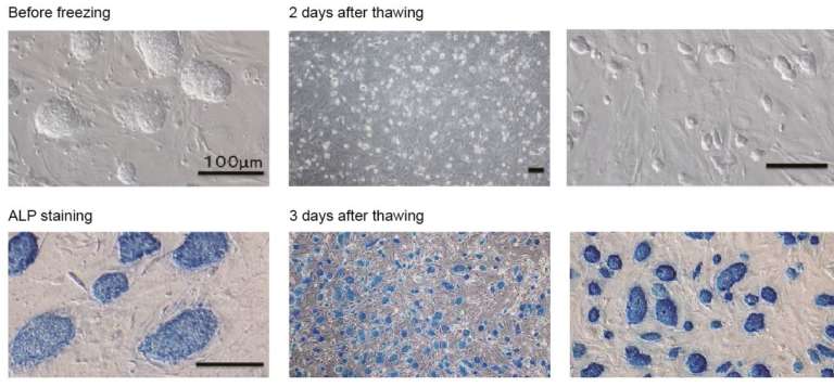 Bambanker - Cell Freezing Medium | NIPPON Genetics EUROPE