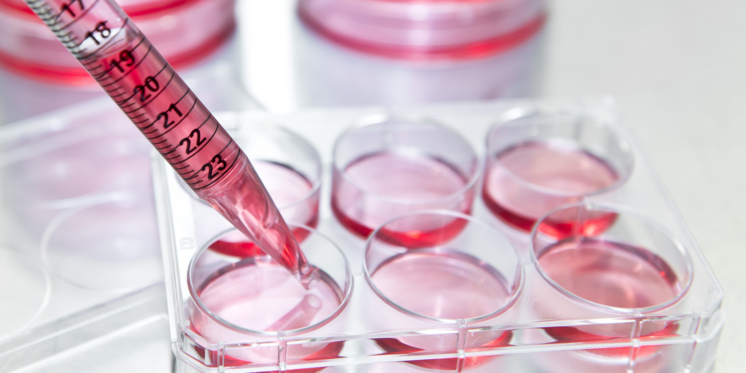 Cell Culture Media for Stem Cells and iPS Cells | NIPPON Genetics EUROPE