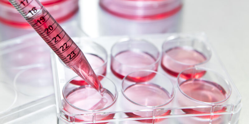 Cell Culture Media for Stem Cells and iPS Cells | NIPPON Genetics EUROPE