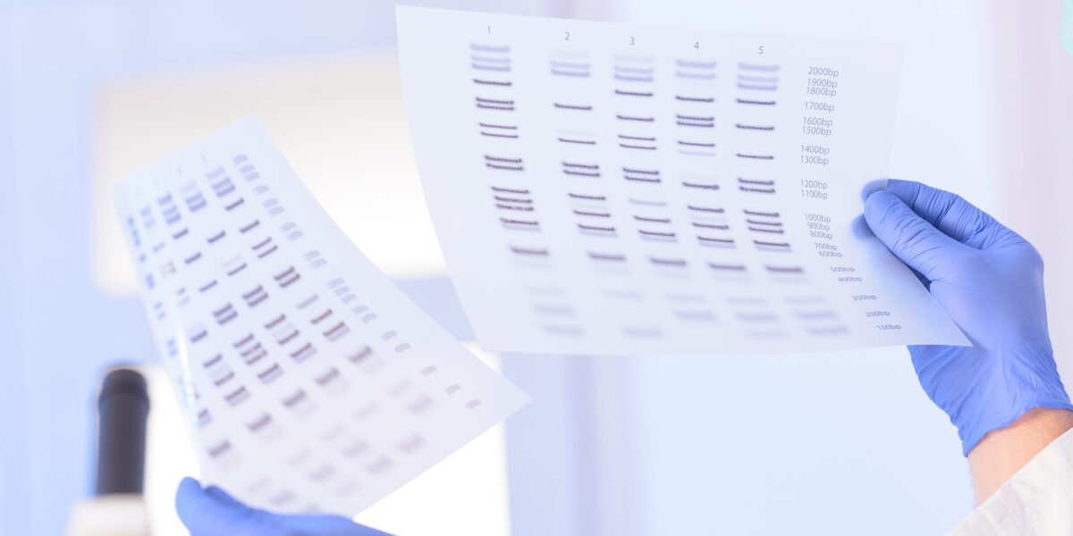 DNA Ladder (ready-to-use) | NIPPON Genetics EUROPE