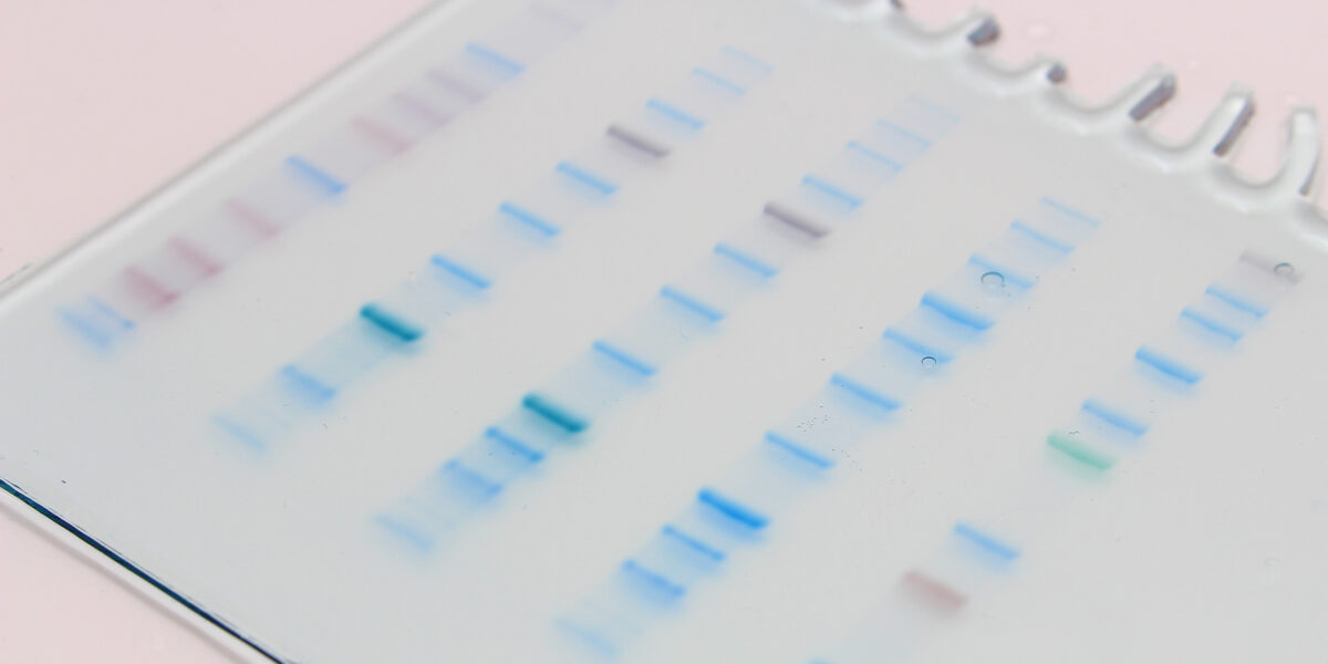 Protein Ladder | NIPPON Genetics EUROPE