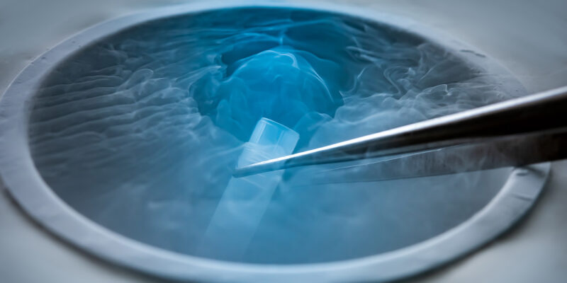 Safe Storage of Biological Samples | NIPPON Genetics EUROPE